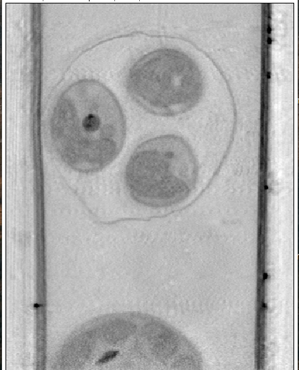 Segment cell organelles with pixellib - ECHEMI