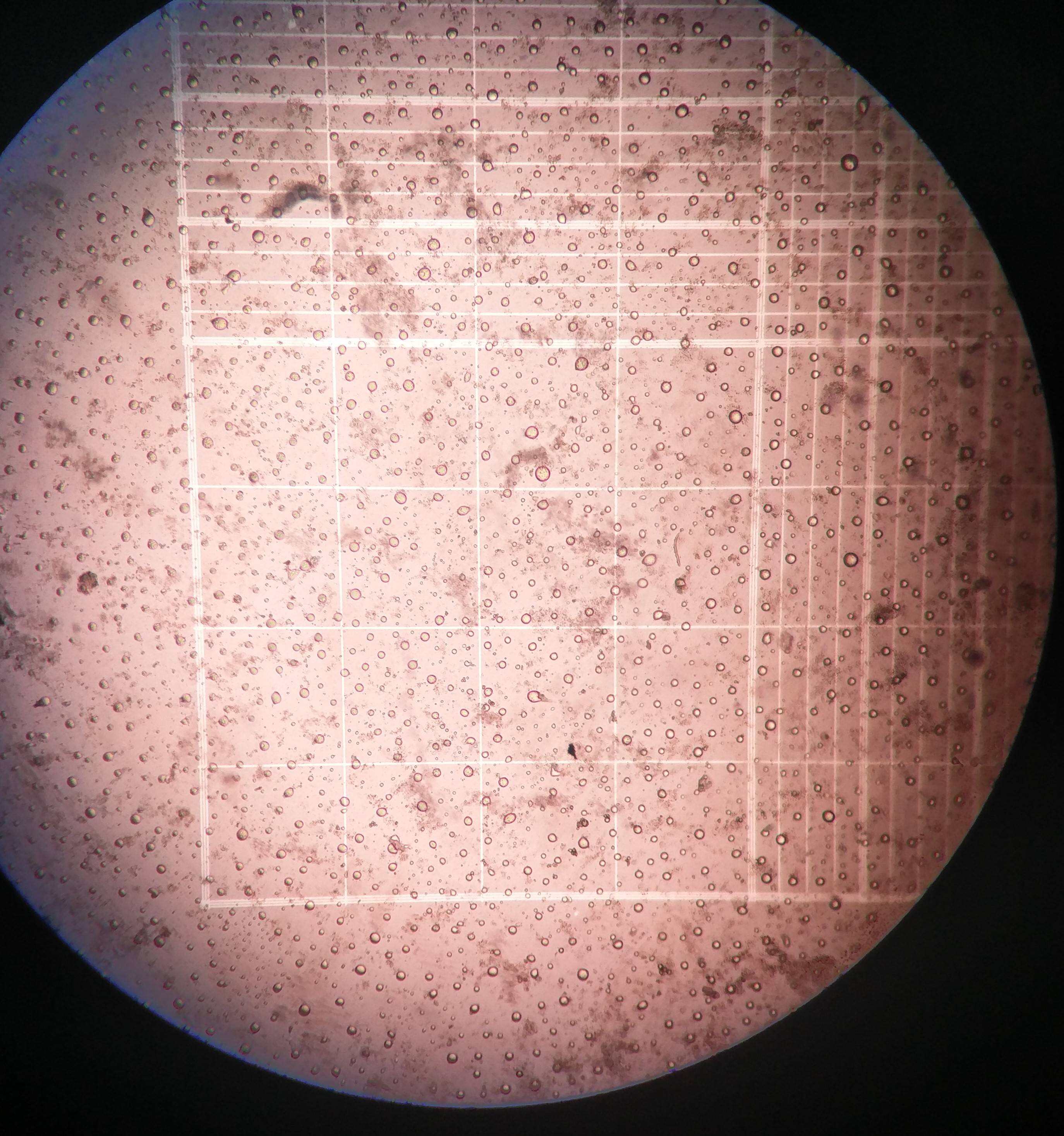 Hemocytometer Counting Of Cells Amrita University, 46% OFF