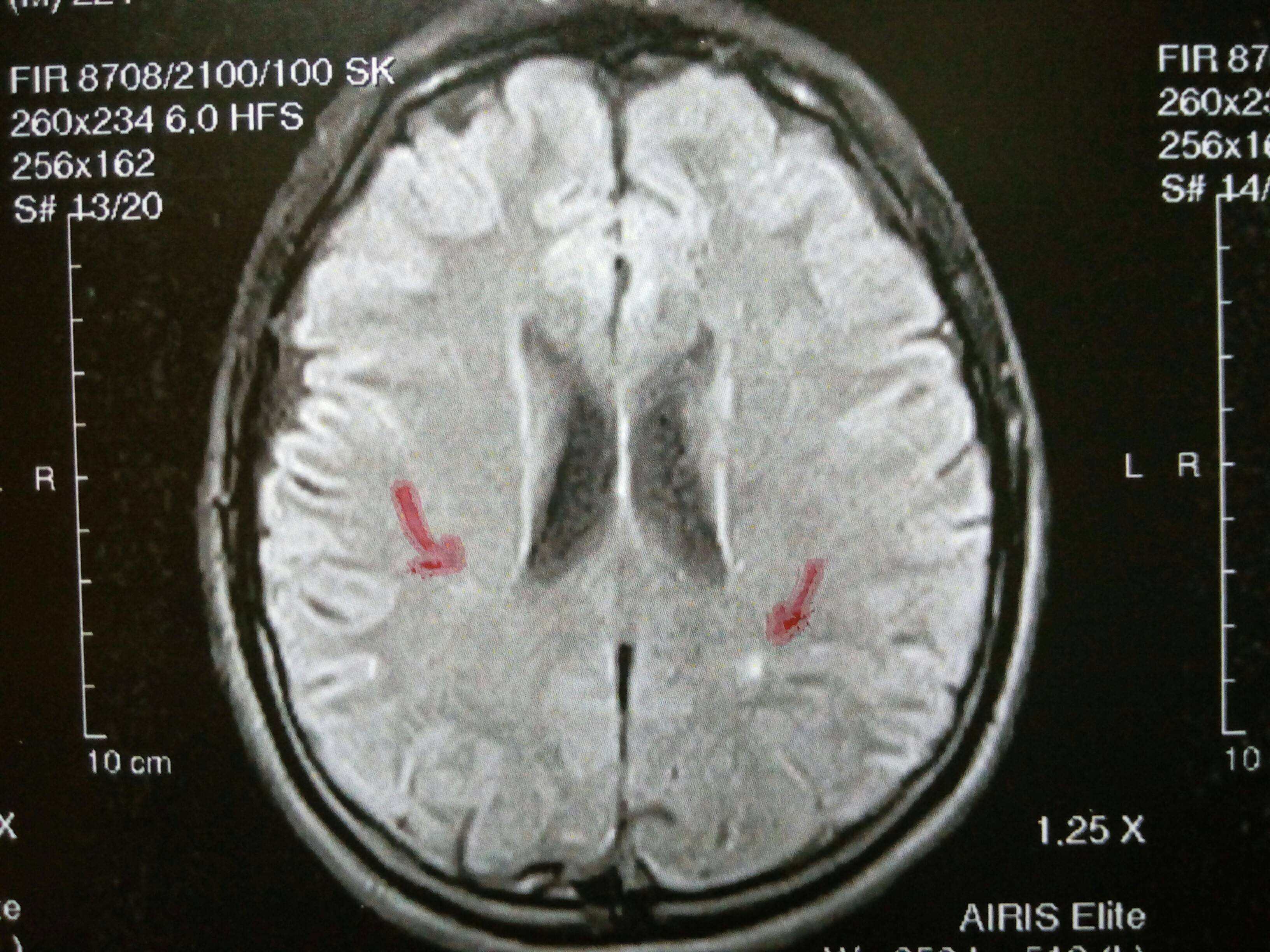 What are the functions of these parts of the brain (MRI)? - ECHEMI