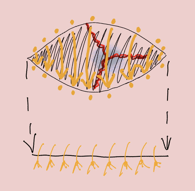 Dealing with triangle puncture wounds - ECHEMI